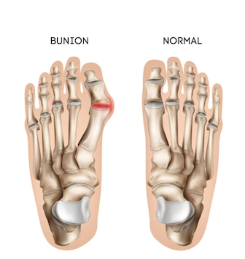Tulang Pergelangan Kaki: Ligamen, Fungsi, Cedera, dan Perawatan – Gramedia Literasi