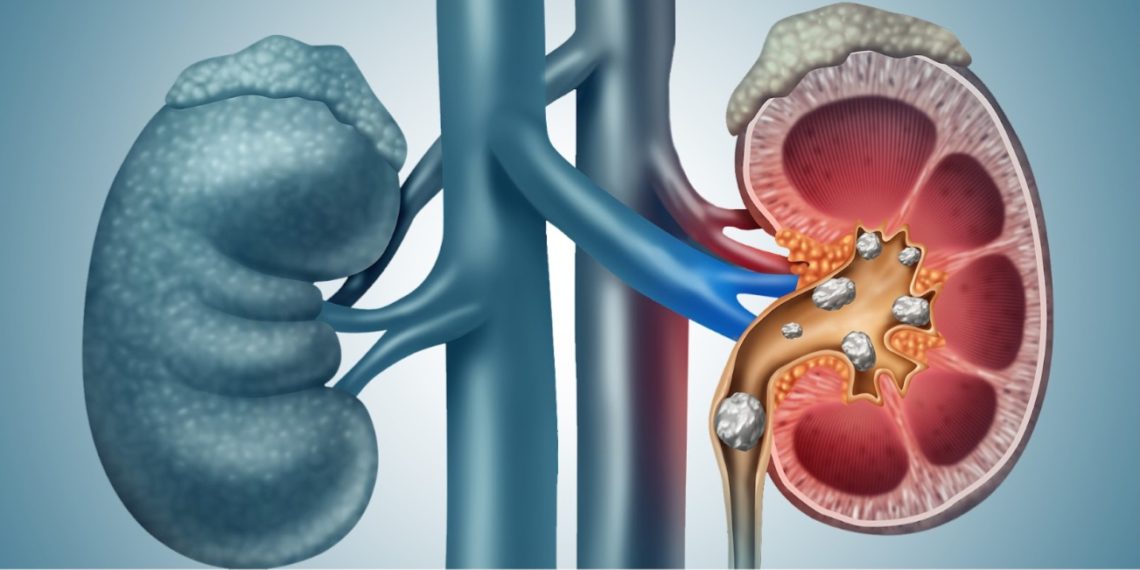 4 Fungsi Glomerulus dalam Ginjal Bagi Tubuh Manusia, Simak Disini ...