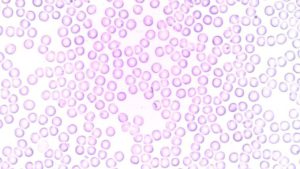 Neutrofil Adalah: Definisi, Fungsi, Jenis, dan Gangguan Fungsi ...